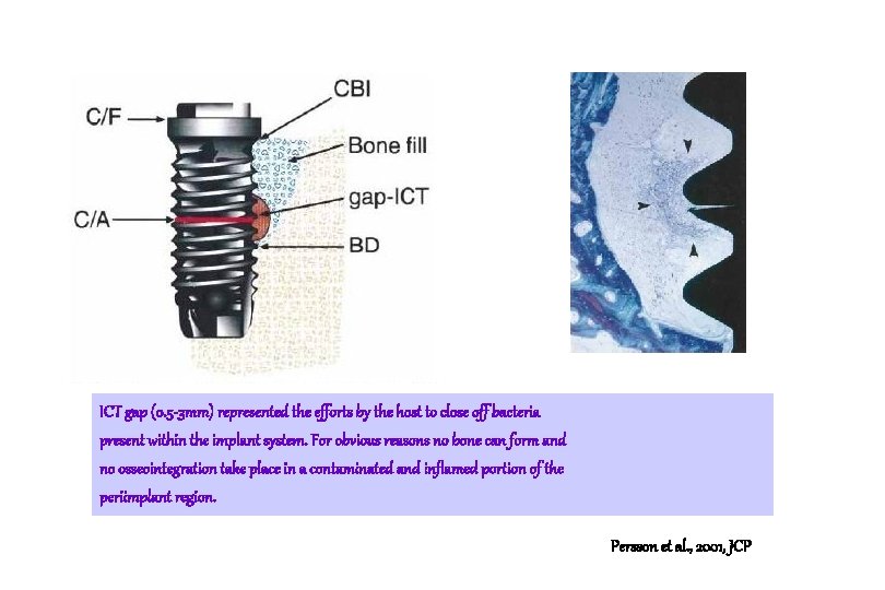 How to treat ailing and failing implants Roland