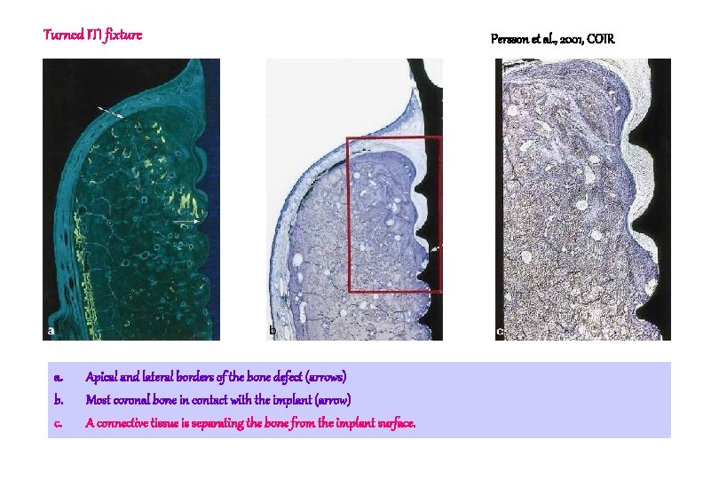 How to treat ailing and failing implants Roland