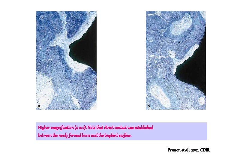 How to treat ailing and failing implants Roland