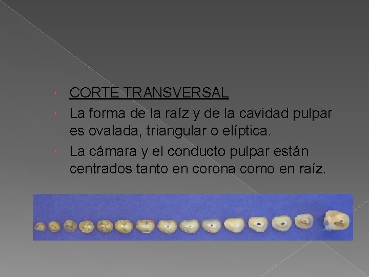 Cavidades pulpares en dientes permanentes ALEJANDRO LEON CARO