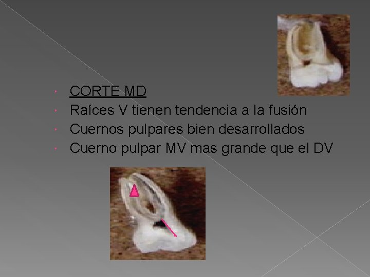 Cavidades pulpares en dientes permanentes ALEJANDRO LEON CARO