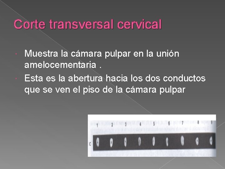 Cavidades pulpares en dientes permanentes ALEJANDRO LEON CARO