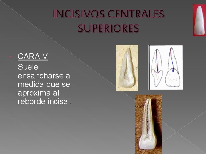 Cavidades pulpares en dientes permanentes ALEJANDRO LEON CARO