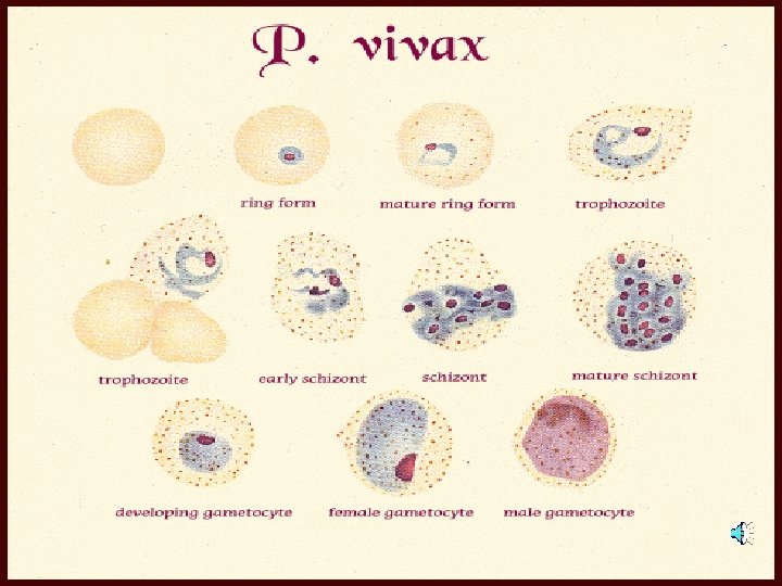 Malaria Alternative names Quartan malaria Falciparum malaria Blackwater