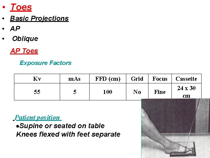 Lecture 13 Toes Basic Projections AP Oblique AP