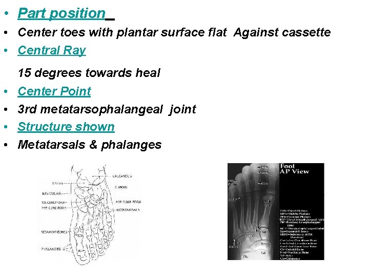 Lecture 13 Toes Basic Projections AP Oblique AP