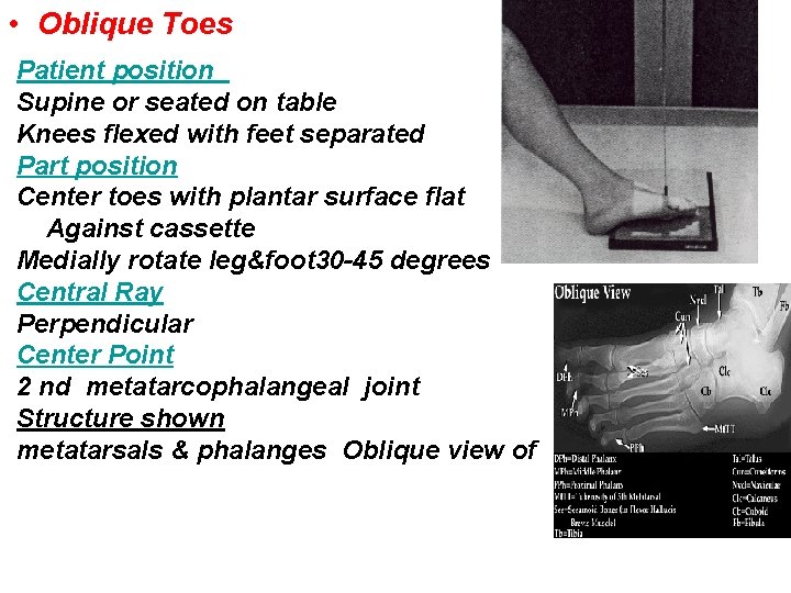 Lecture 13 Toes Basic Projections AP Oblique AP
