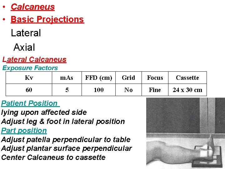 Lecture 13 Toes Basic Projections AP Oblique AP
