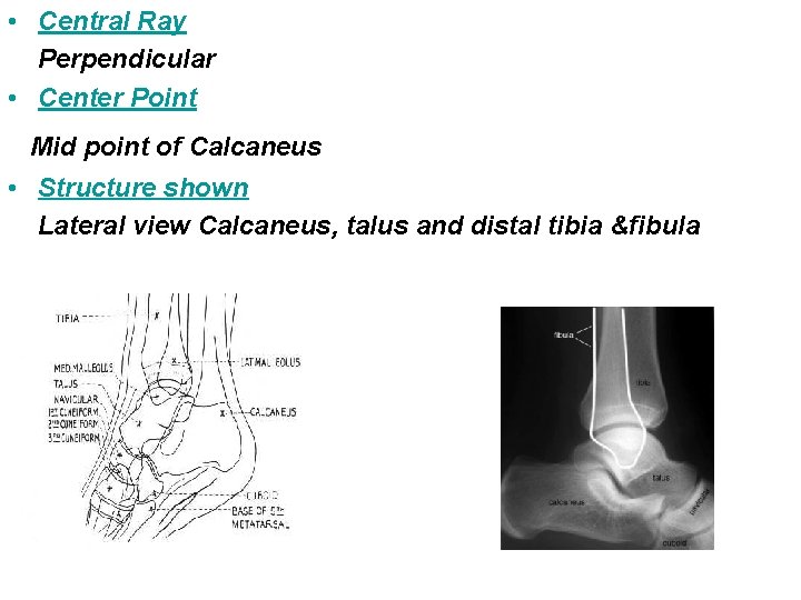 Lecture 13 Toes Basic Projections AP Oblique AP