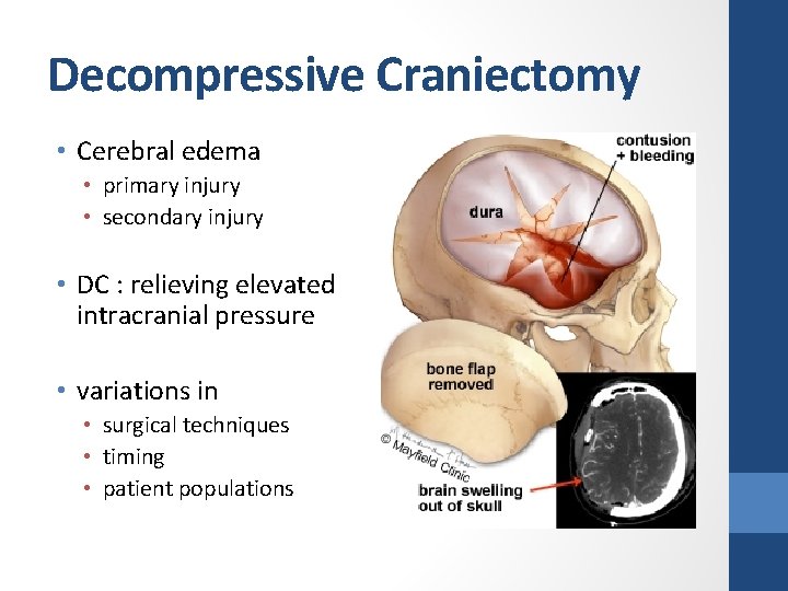 Guidelines for the Management of Severe Traumatic Brain