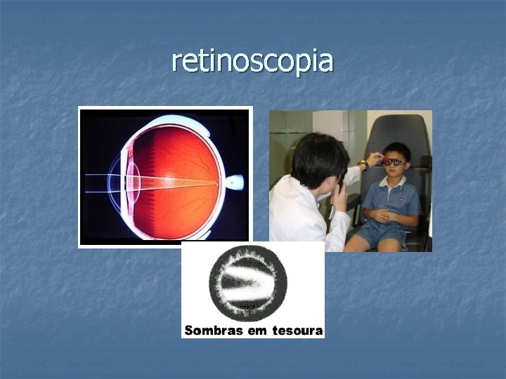 EXAME PERICIAL OFTALMOLGICO Carla Eugnia Mallmann 2014 objetivo