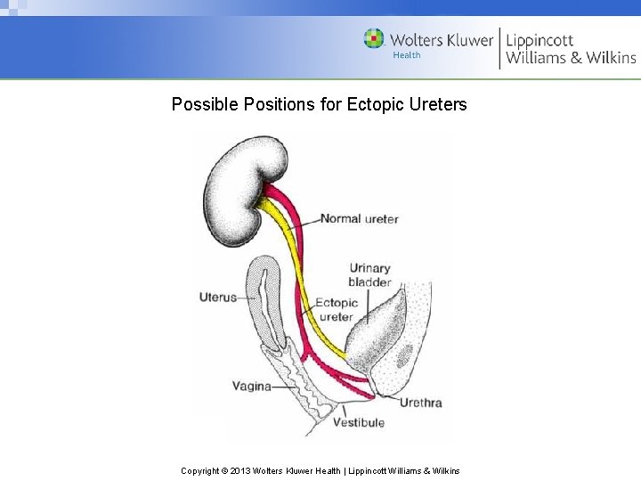 Lecture 7 Urogenital System Copyright 2013 Wolters Kluwer