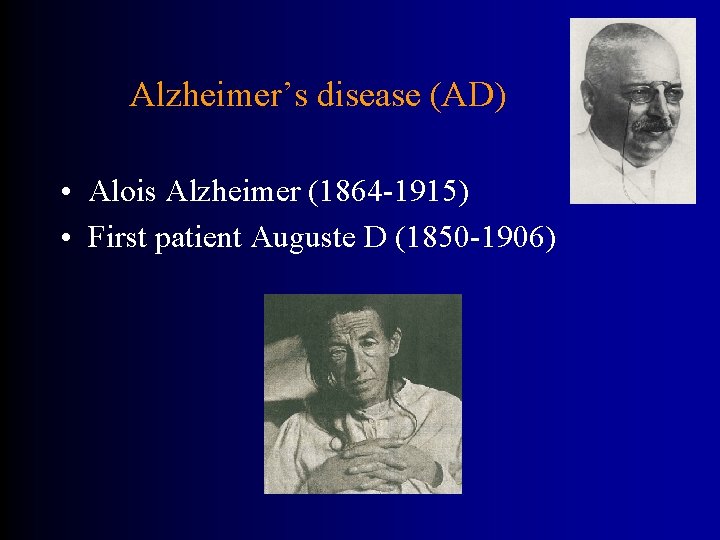 Understanding the pathology of Alzheimers disease by profiling