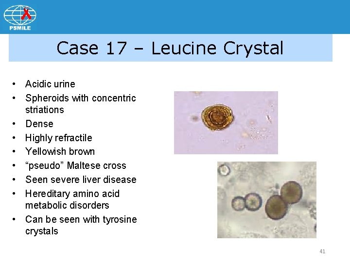 Patient Safety Monitoring in International Laboratories SMILE Urine