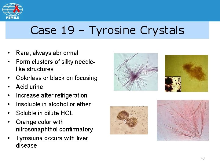 Patient Safety Monitoring in International Laboratories SMILE Urine