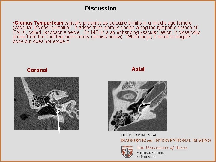Principal Modality 1 CT Radiological Category Neuroradiology Principal