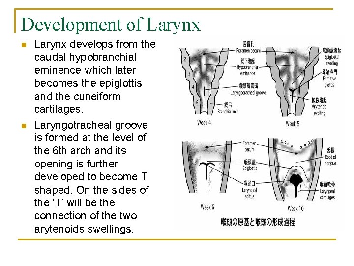 Congenital Anomalies of Larynx n n The larynx