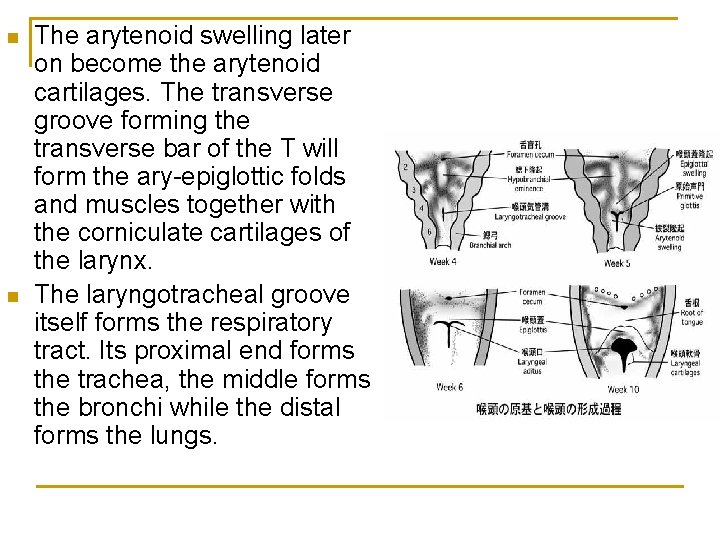 Congenital Anomalies of Larynx n n The larynx