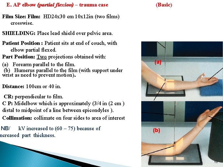 RAD 222 Upper extremity part 2 forearm elbow