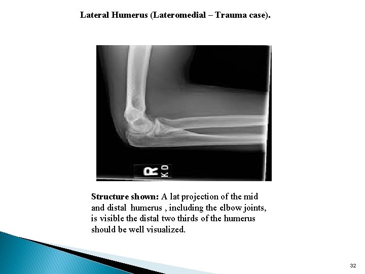 RAD 222 Upper extremity part 2 forearm elbow