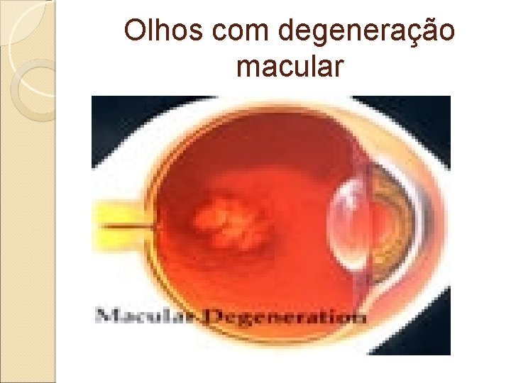 ANATOMIA RETINA INSTITUTO FILADLFIA ptica Turma 20 ANATOMIA