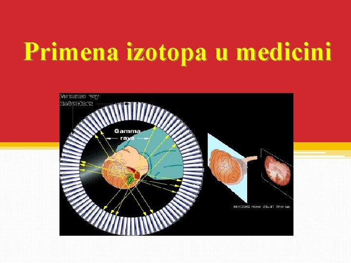 Primena izotopa u medicini ta su izotopi Atomi