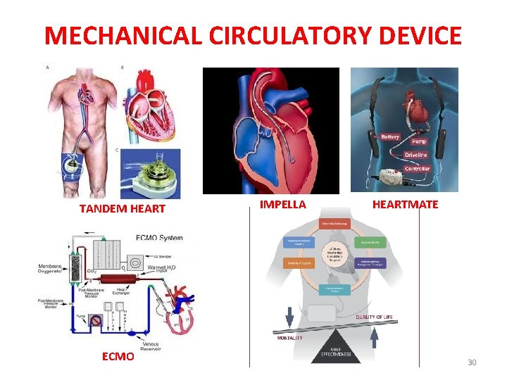 HEART FAILURE DR DIBBENDHU KHANRA MD DNB MRCP