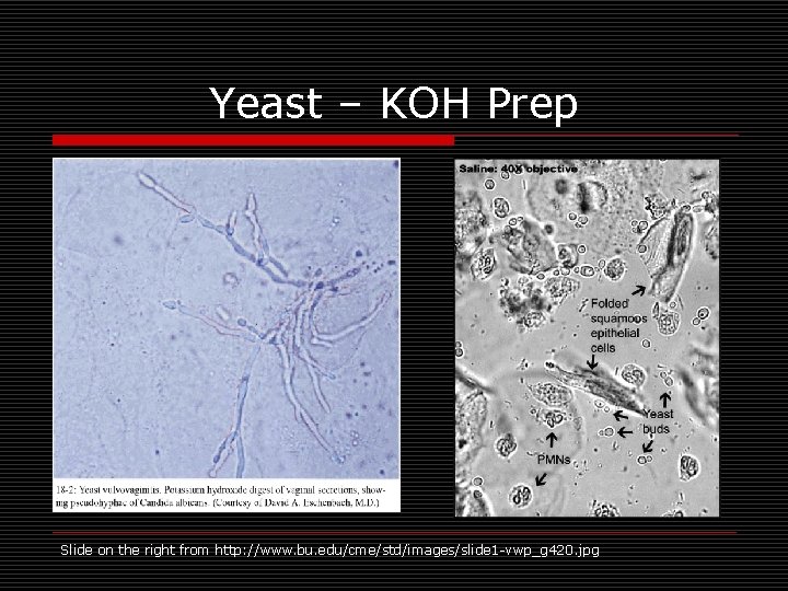 VAGINAL HYGIENE AND VAGINITIS Original outline by Ellen