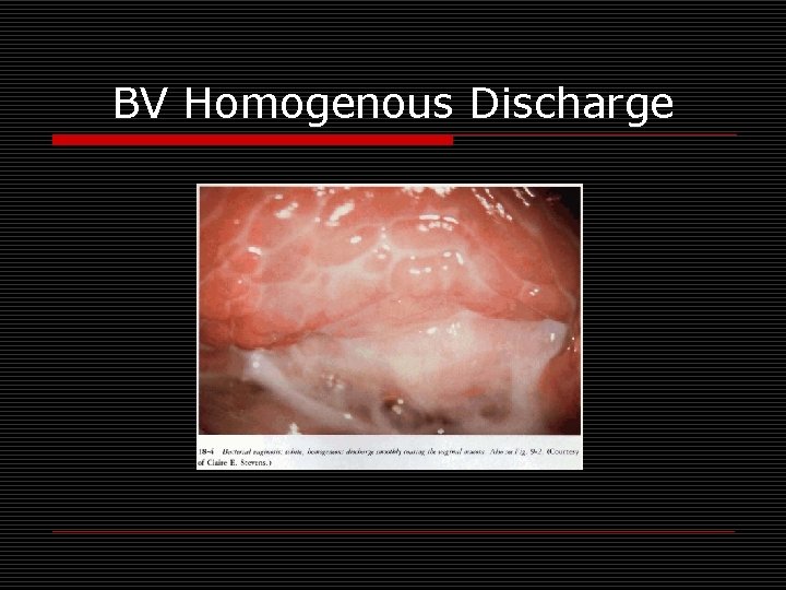 VAGINAL HYGIENE AND VAGINITIS Original outline by Ellen