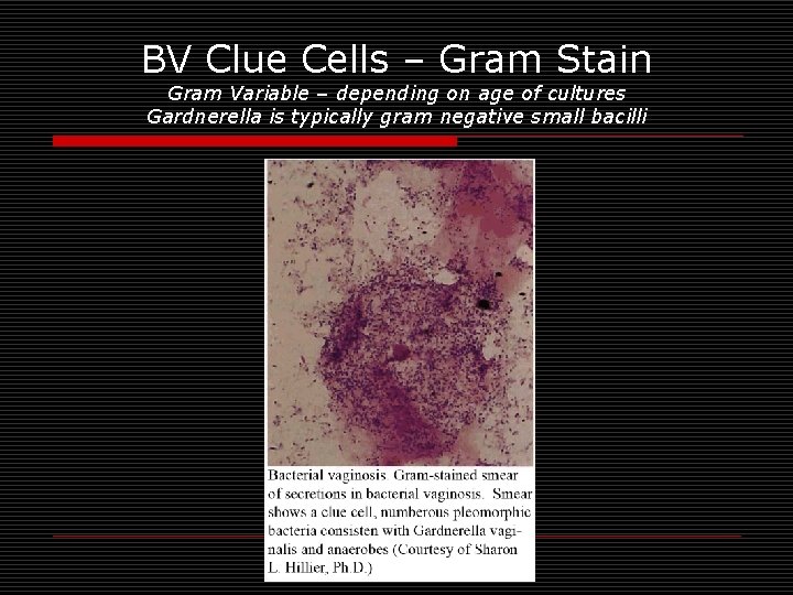 VAGINAL HYGIENE AND VAGINITIS Original outline by Ellen