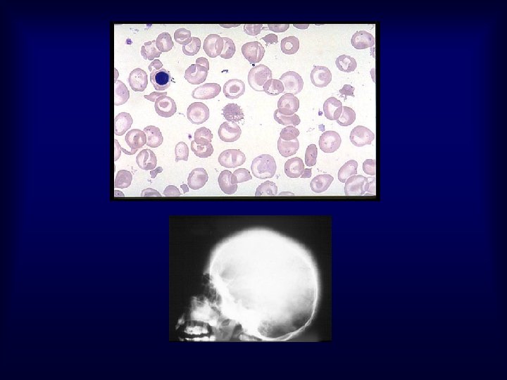 Cours dHmatocytologie DUT ABB 5 physiopathologie des globules