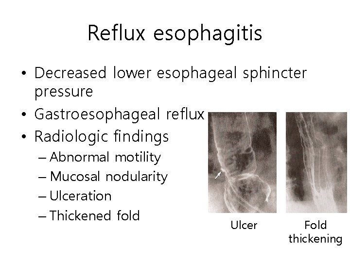 Radiologic Dx of GI Tract Dong Ho LEE