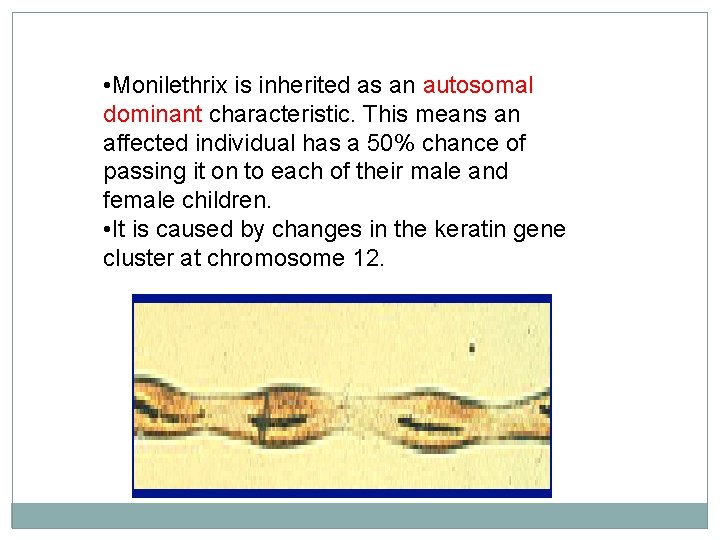 Hair shaft disorders GITI SADEGHIAN DERMATOLOGIST SKIN DISEASES