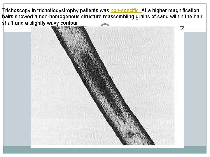 Hair shaft disorders GITI SADEGHIAN DERMATOLOGIST SKIN DISEASES