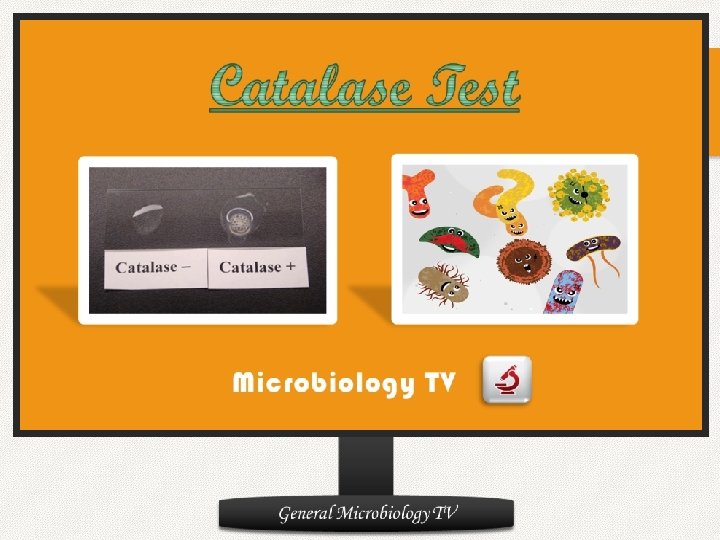 Enzymes v In the microbiology lab biochemical test