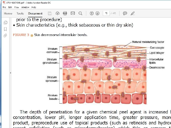 Chemical Peeling Introduction remove the outer layers of