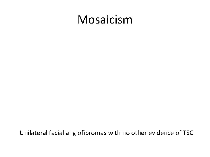 Skin Manifestations of Tuberous Sclerosis Complex Julie Prendiville