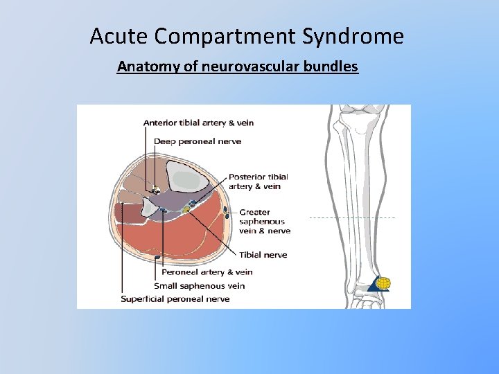 Acute Compartment Syndrome Viktoras Kubaitis 10092012 Acute Compartment