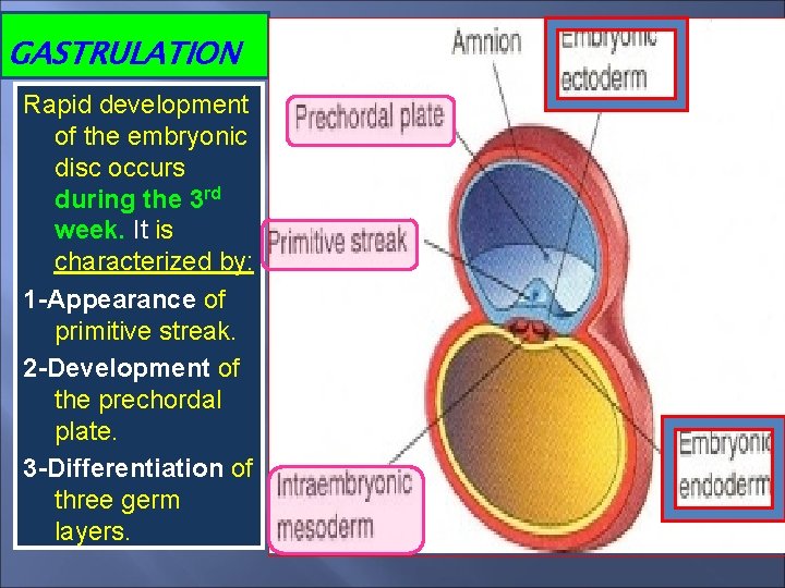 BILAMINAR TRILAMINAR DISCS THEIR DERIVATIVES By DRS SANAA