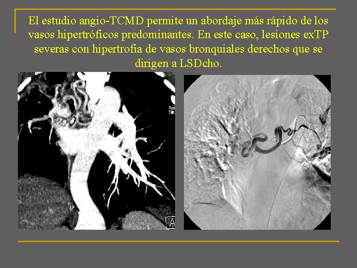 DETECCIN DE PATOLOGIA PULMONARMEDIASTNICA COMO CAUSA PRIMARIA DE