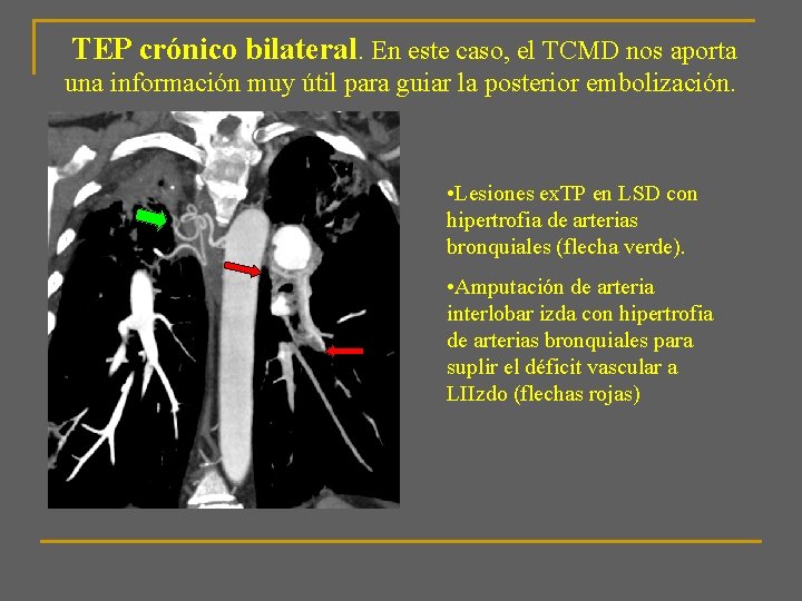DETECCIN DE PATOLOGIA PULMONARMEDIASTNICA COMO CAUSA PRIMARIA DE