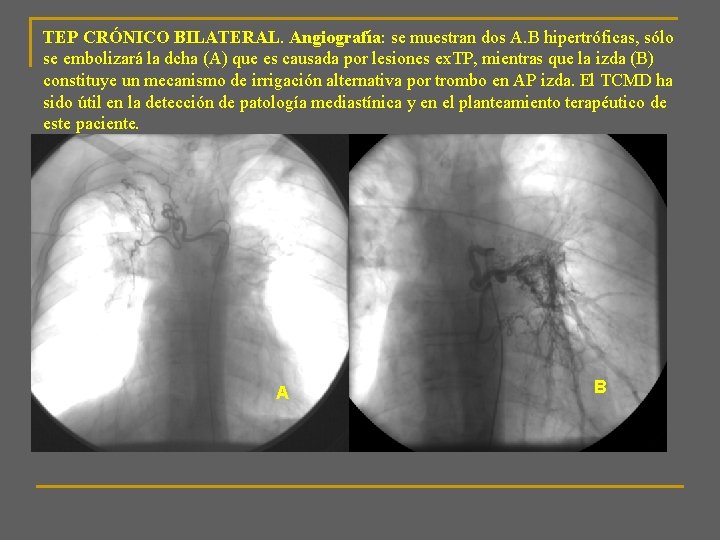 DETECCIN DE PATOLOGIA PULMONARMEDIASTNICA COMO CAUSA PRIMARIA DE