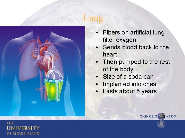 Artificial Lung Edwin Sam Robert Bartlett MD Surgeon