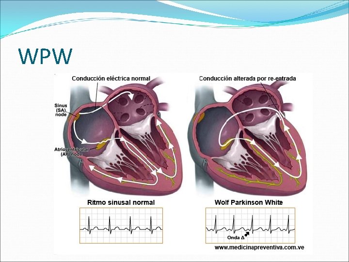 ELECTROCARDIOGRAFA BSICA EN URGENCIAS Gregorio Laguna Nez MIR