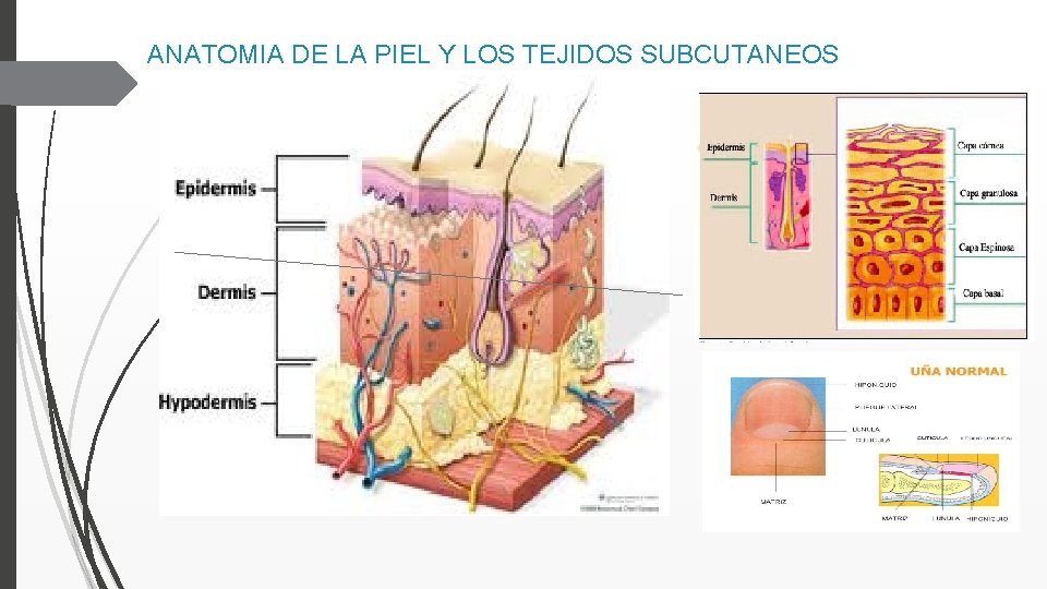 INFECCIONES BACTERIANAS DE LA PIEL Y TEJIDOS SUBCUTANEOS