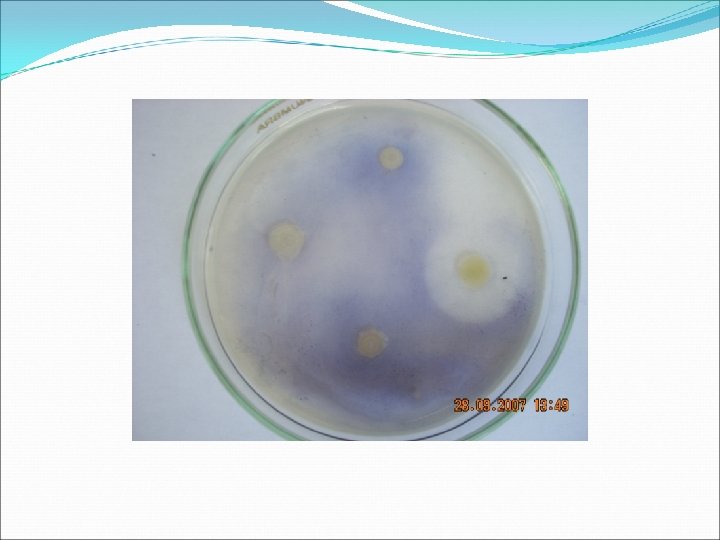 IDENTIFIKASI KLASIFIKASI DAN TAKSONOMI BAKTERI BEBERAPA CARA IDENTIFIKASI