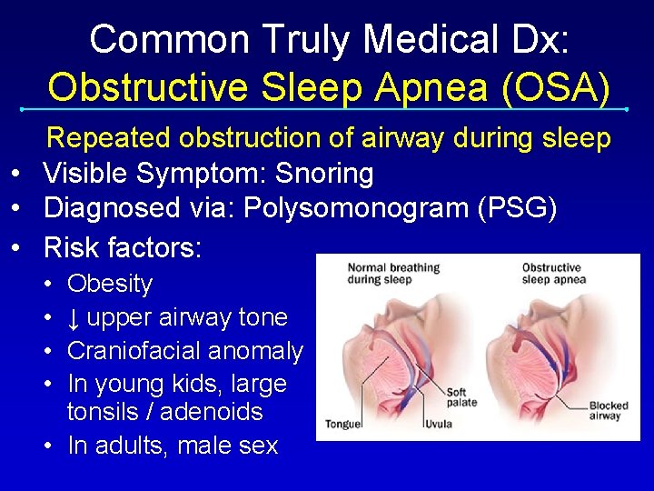 Behavioral Sleep Strategies After Pediatric Brain Injury Dean