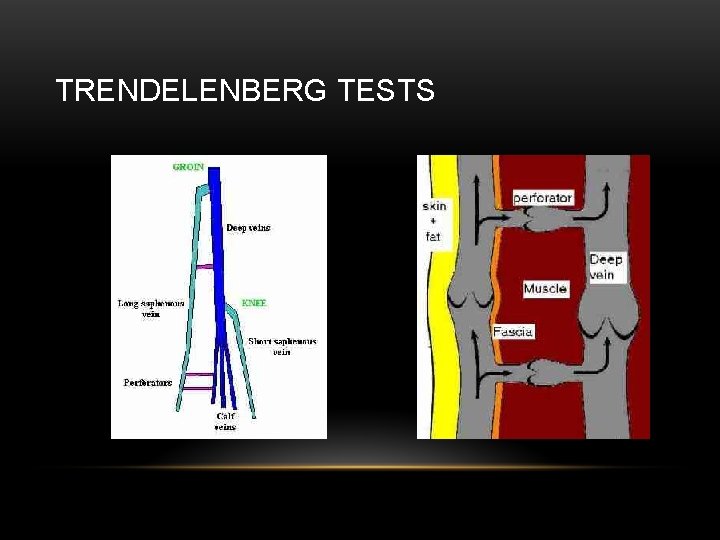 PERIPHERAL VASCULAR SYSTEM EXAMINATION Miss Sandy Abeysiri Clinical