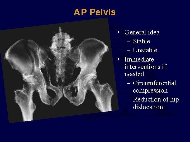 Radiographic Evaluation and Classification of Pelvic Ring Disruptions