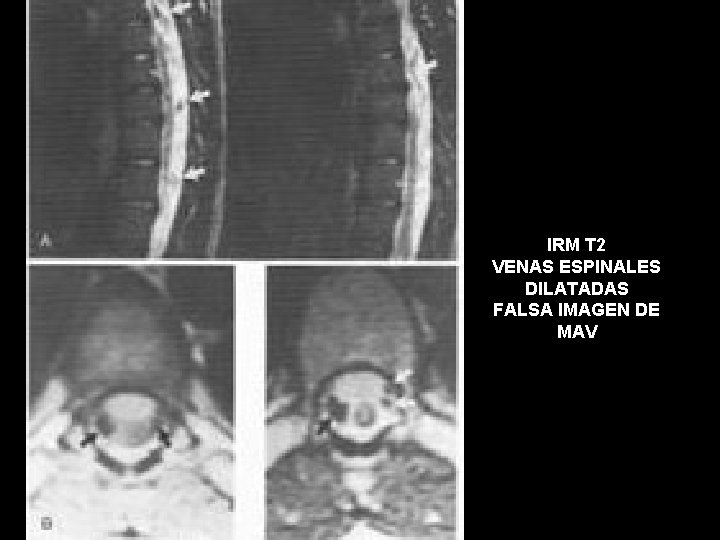 Tema 9 Columna vertebral y mdula RX Y